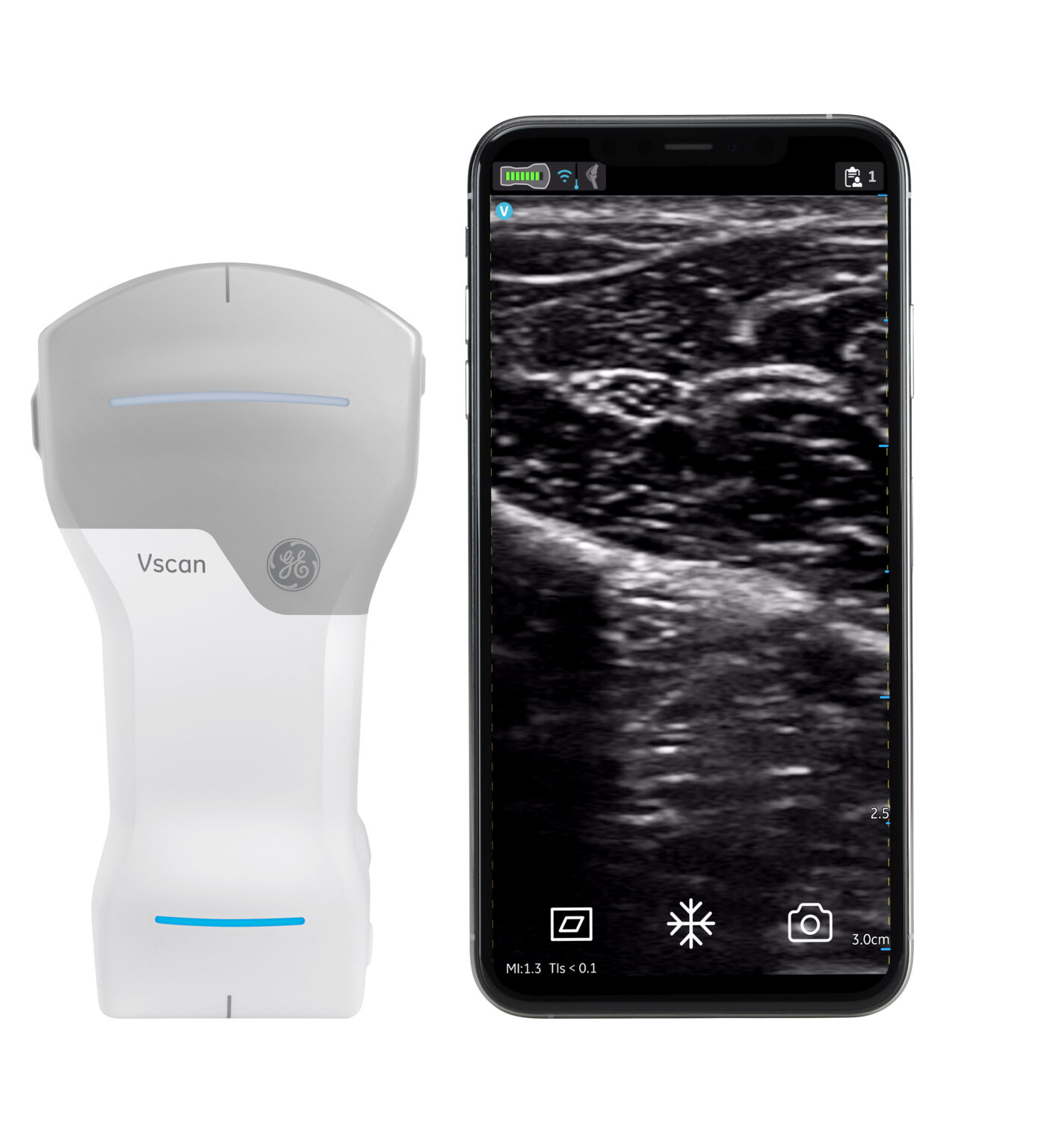 Vscan Air™ CL VET | Antech Diagnostics